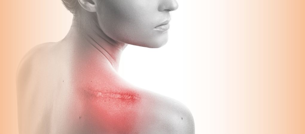 Cicatrici - Osteopedia - il portale mondiale dell'osteopatia